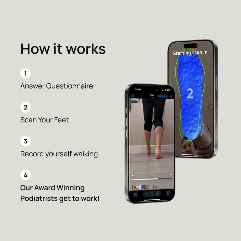 Custom Orthotics for Flat Feet | Stridesoles Insoles