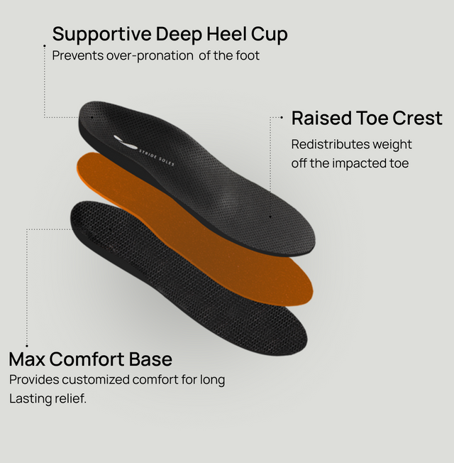 Custom Orthotics for Hammer Toes | StrideSoles Insoles