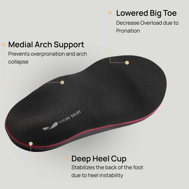 Custom Orthotics for Flat Feet | Stridesoles Insoles